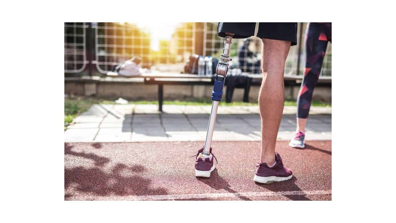 Different Types Of Prosthetic Legs, What You Need To Know About Them ...