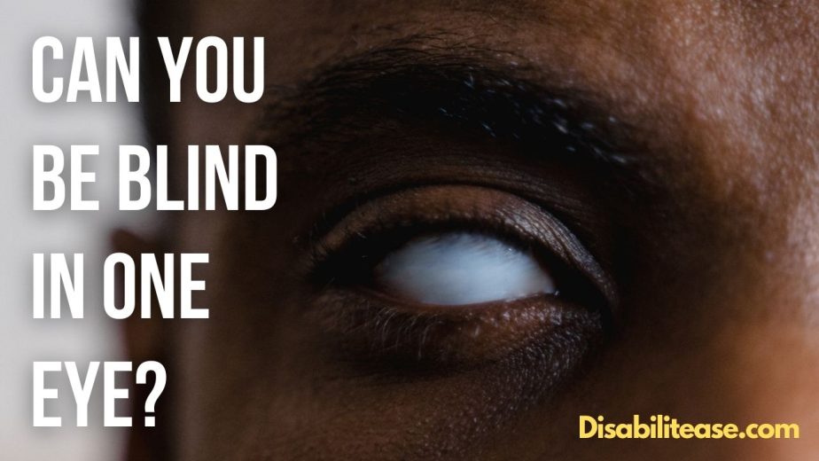 Can You Be Blind In One Eye? – Disabilitease